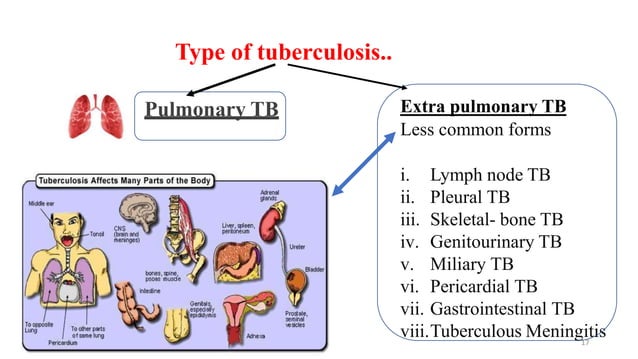 Part- 1. Pathophysiology of TB and 1st and 2nd line AKT, DR. Kiran G ...