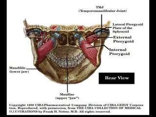 Pterygoid Plate Netter