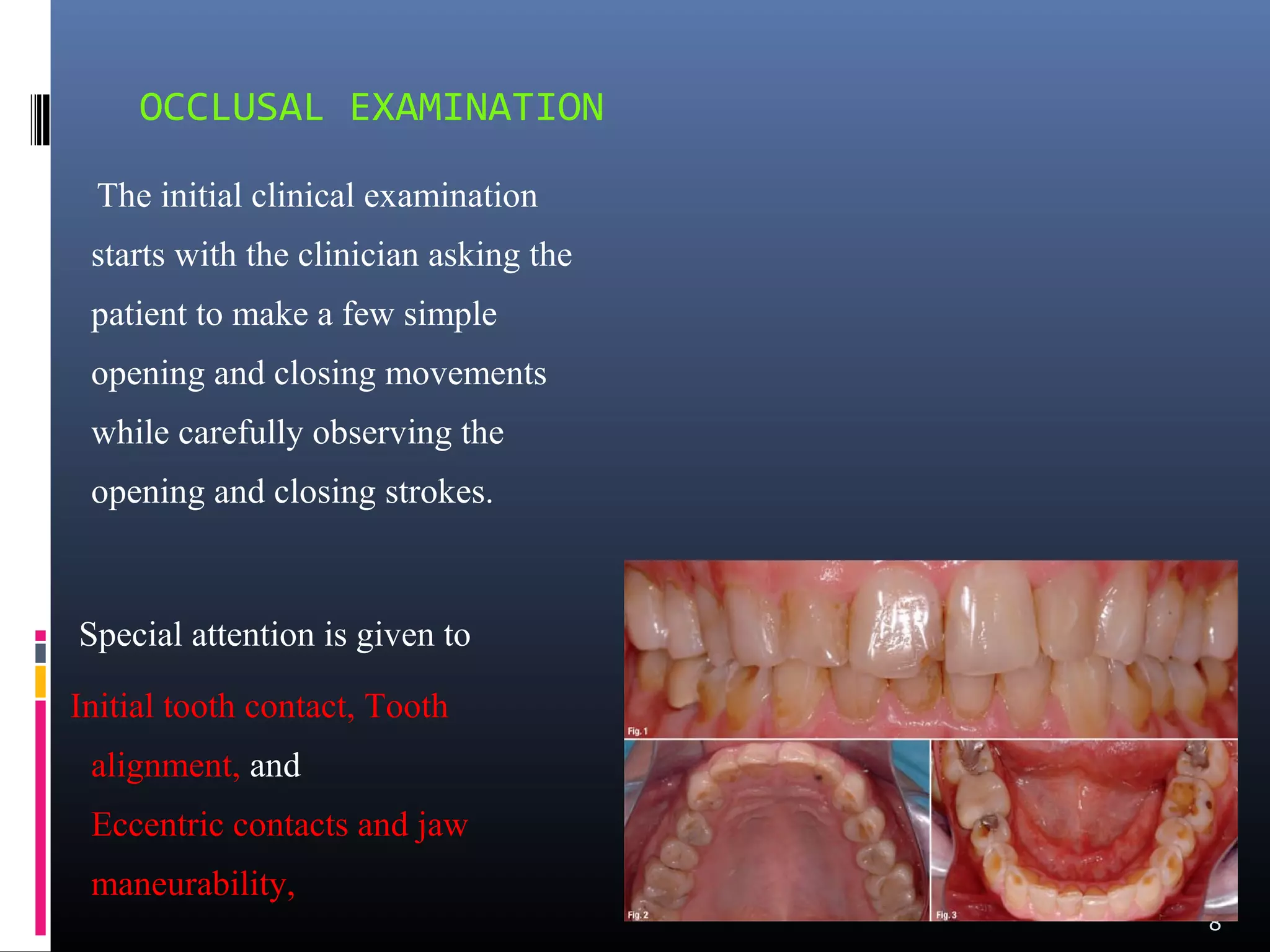 Part 2 diagnosis & T/t plannning in FPD | PPT