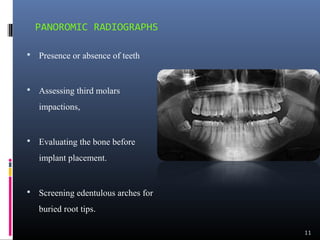 Part 2 diagnosis & T/t plannning in FPD | PPT