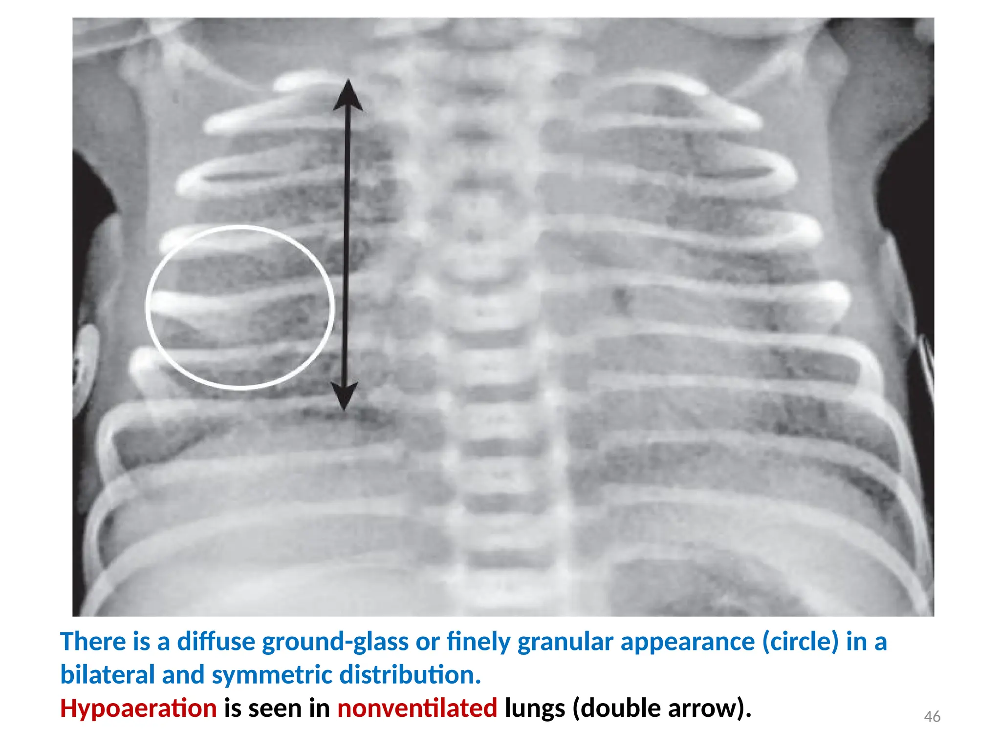 PART-2 COMMON NEONATAL PROBLEMS. (2).pptx