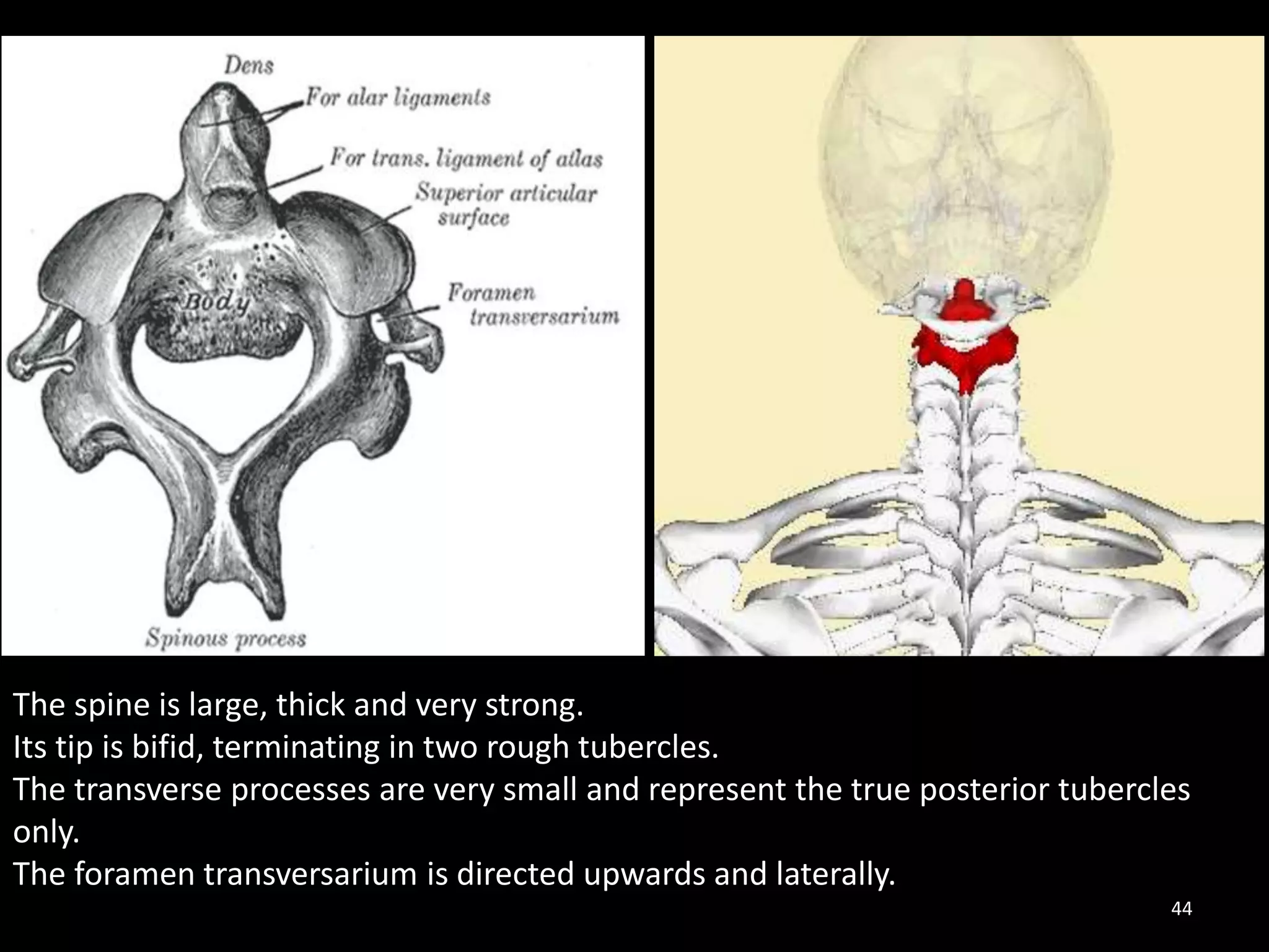 Osteological and radiological anatomy of skull and cervical (Part 2) | PPTX