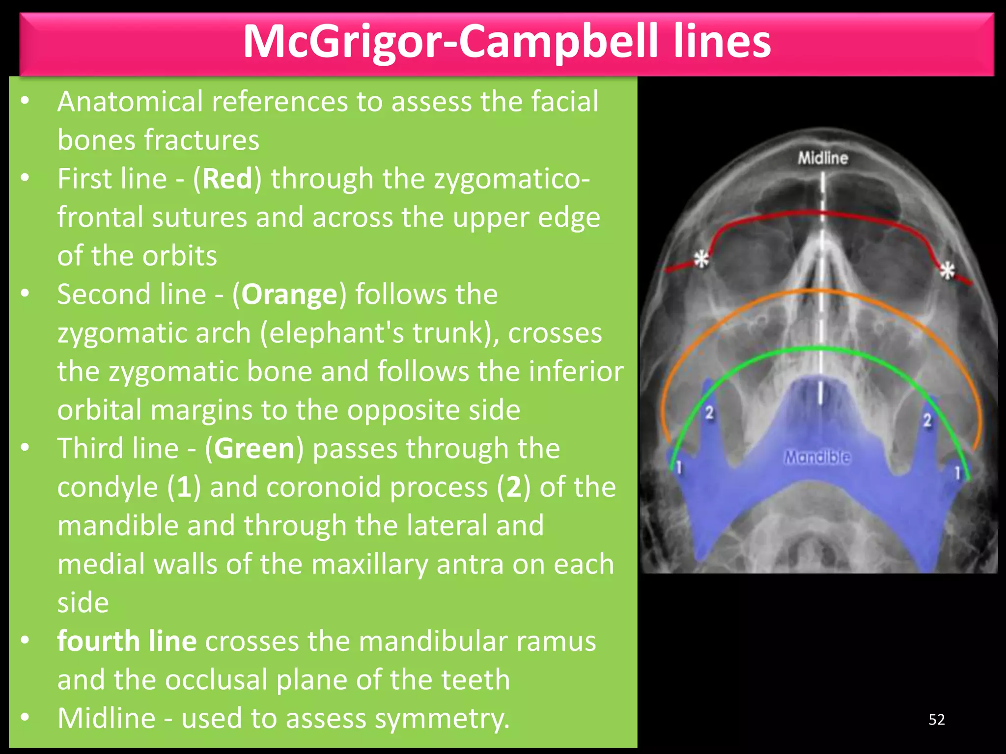 Osteological and radiological anatomy of skull and cervical (Part 2) | PPTX