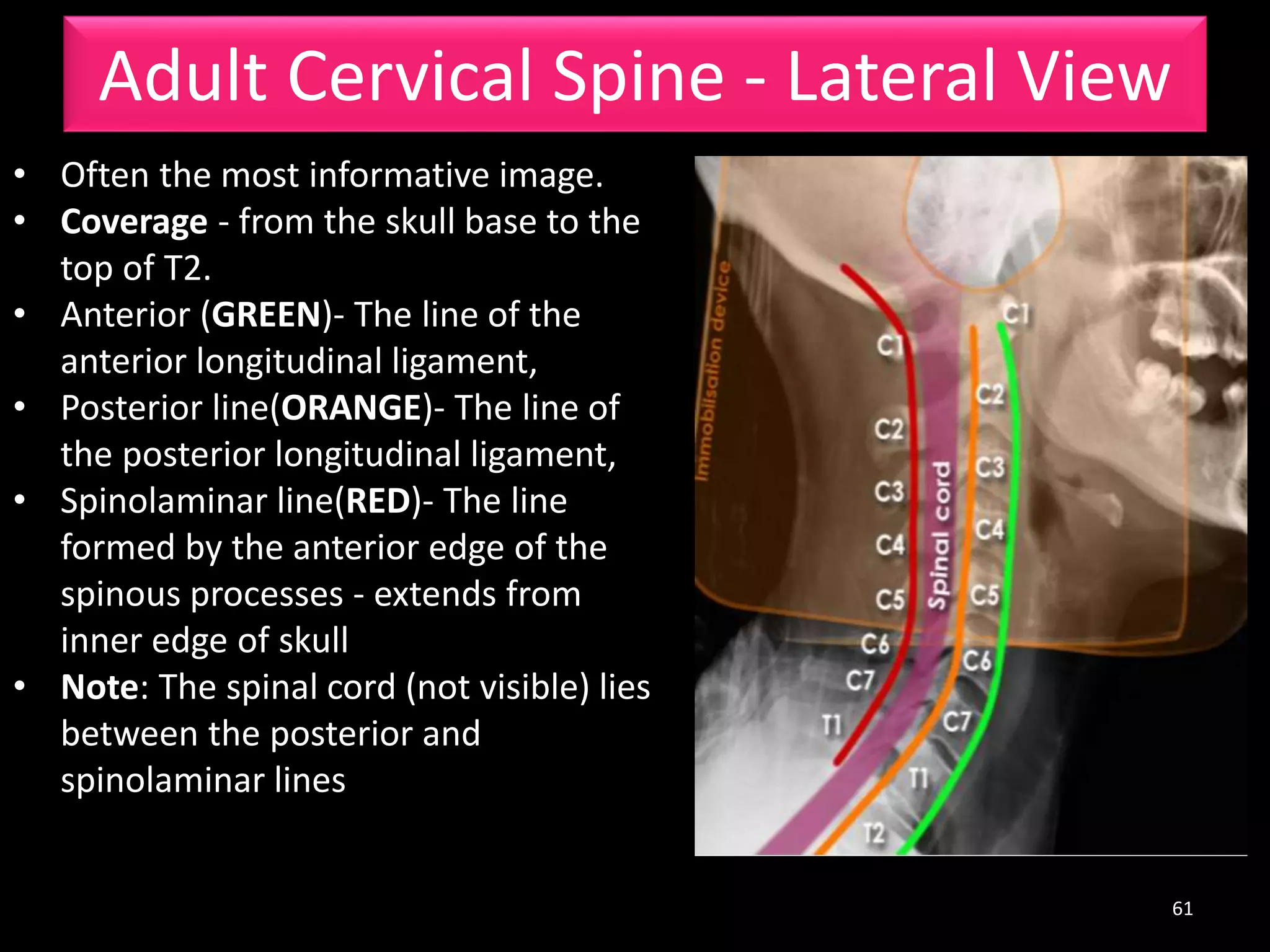 Osteological and radiological anatomy of skull and cervical (Part 2) | PPTX
