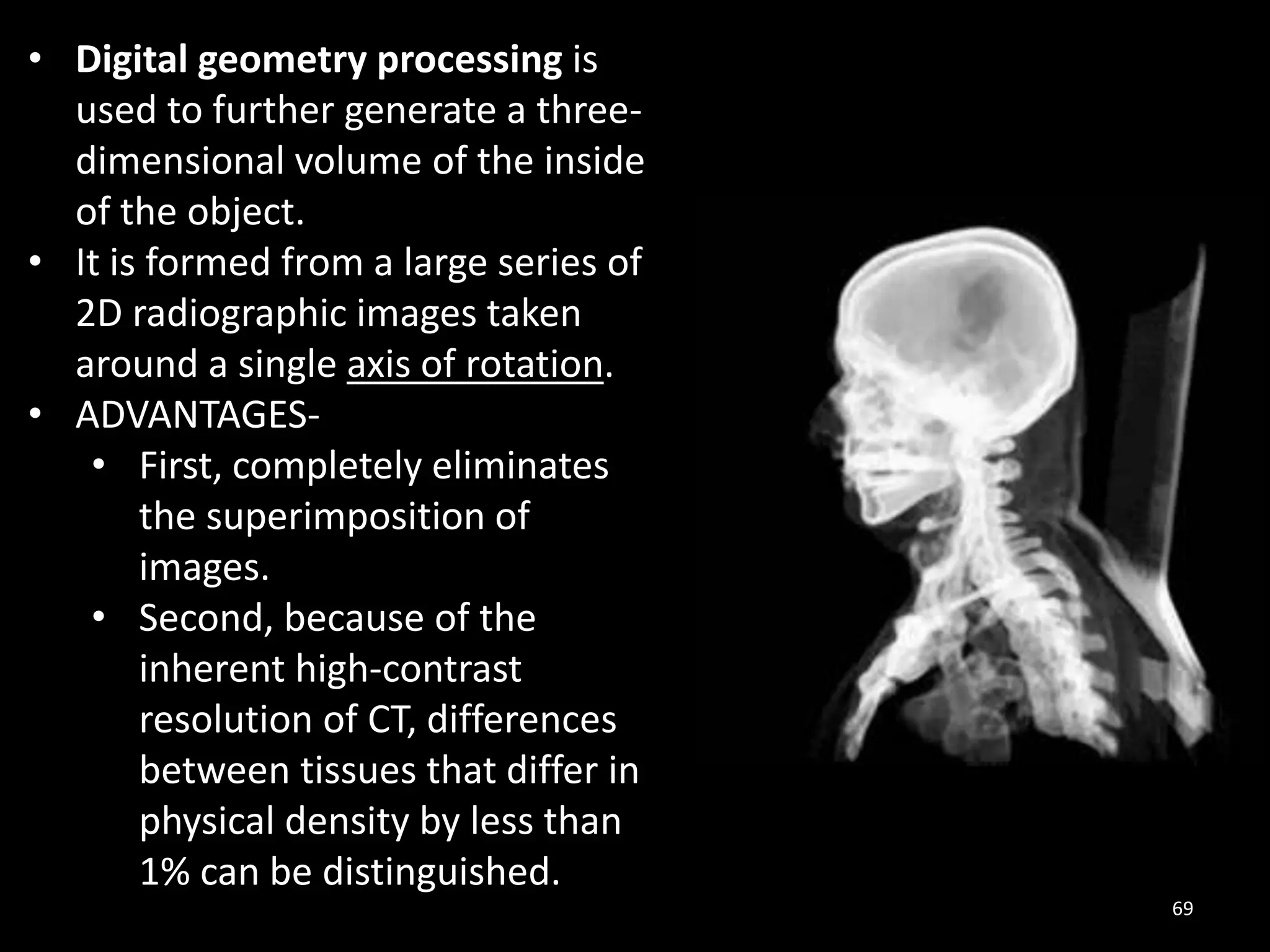 Osteological and radiological anatomy of skull and cervical (Part 2) | PPTX
