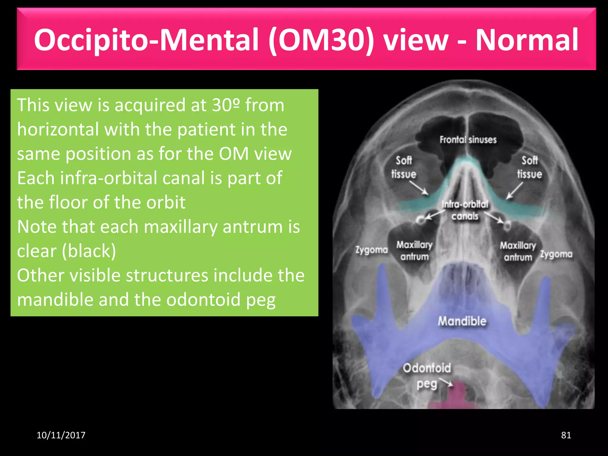 Osteological and radiological anatomy of skull and cervical (Part 2) | PPTX