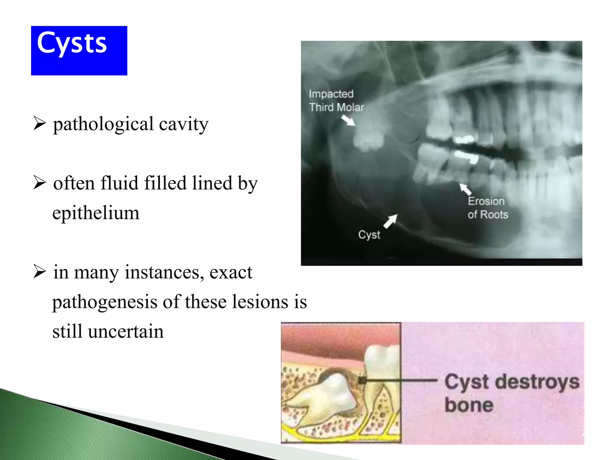 CYSTS OF THE JAW Part 1 | PPTX