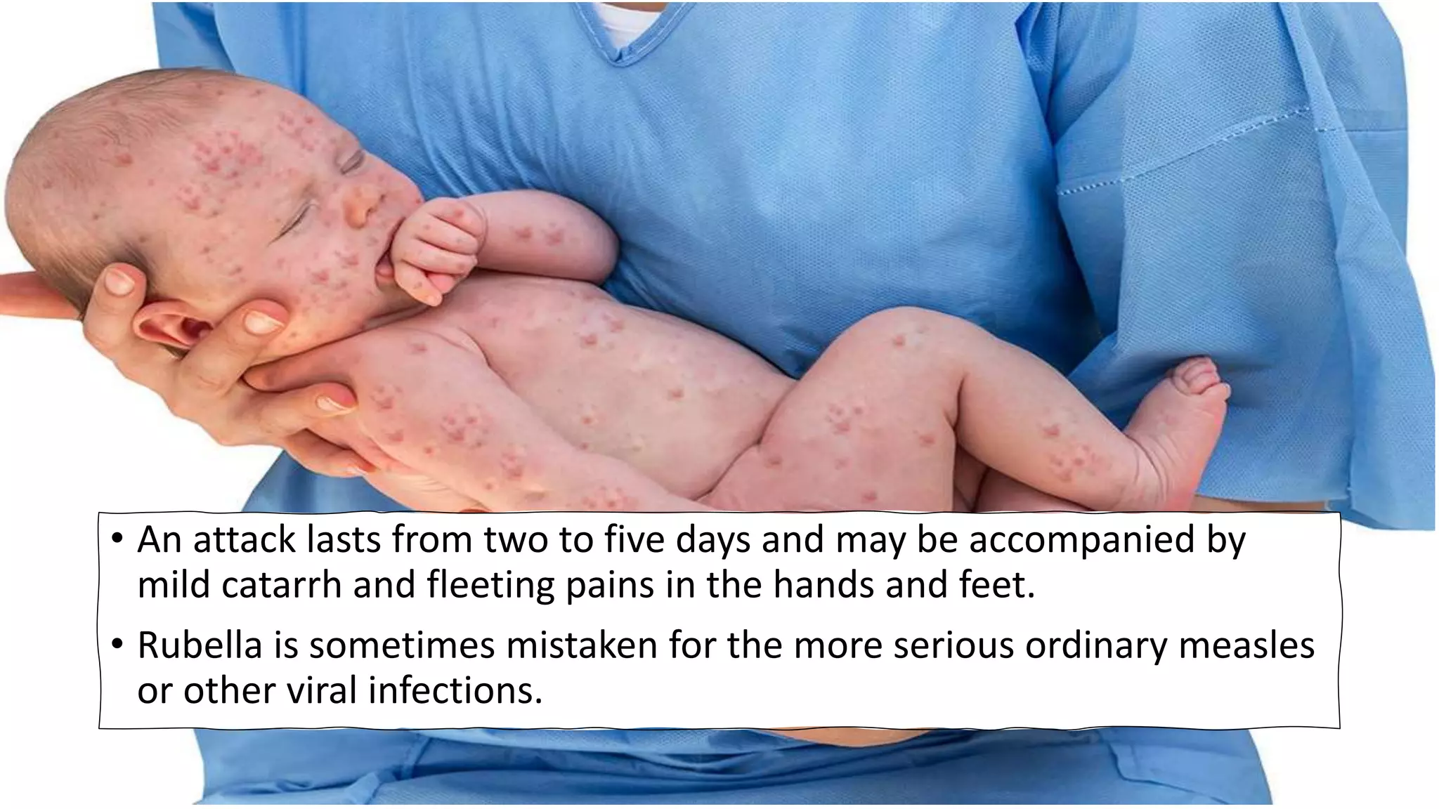 Blindness and Low Vision | PPTX