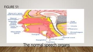 Students with Speech and Language Disorder 1 | PPTX