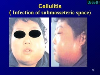 Part1.Anatomy | PPT