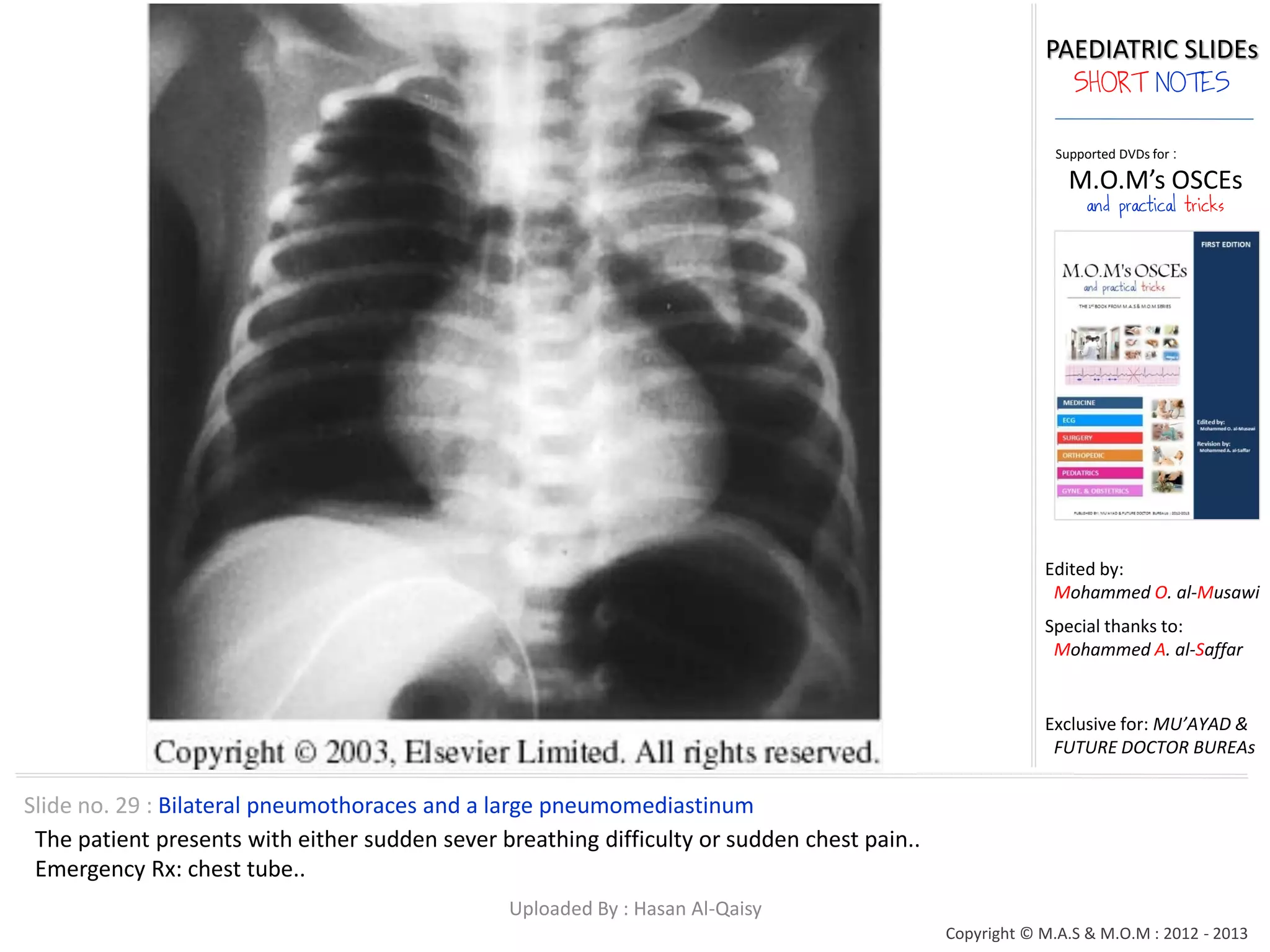 Part 1 paediatric slides | PPT