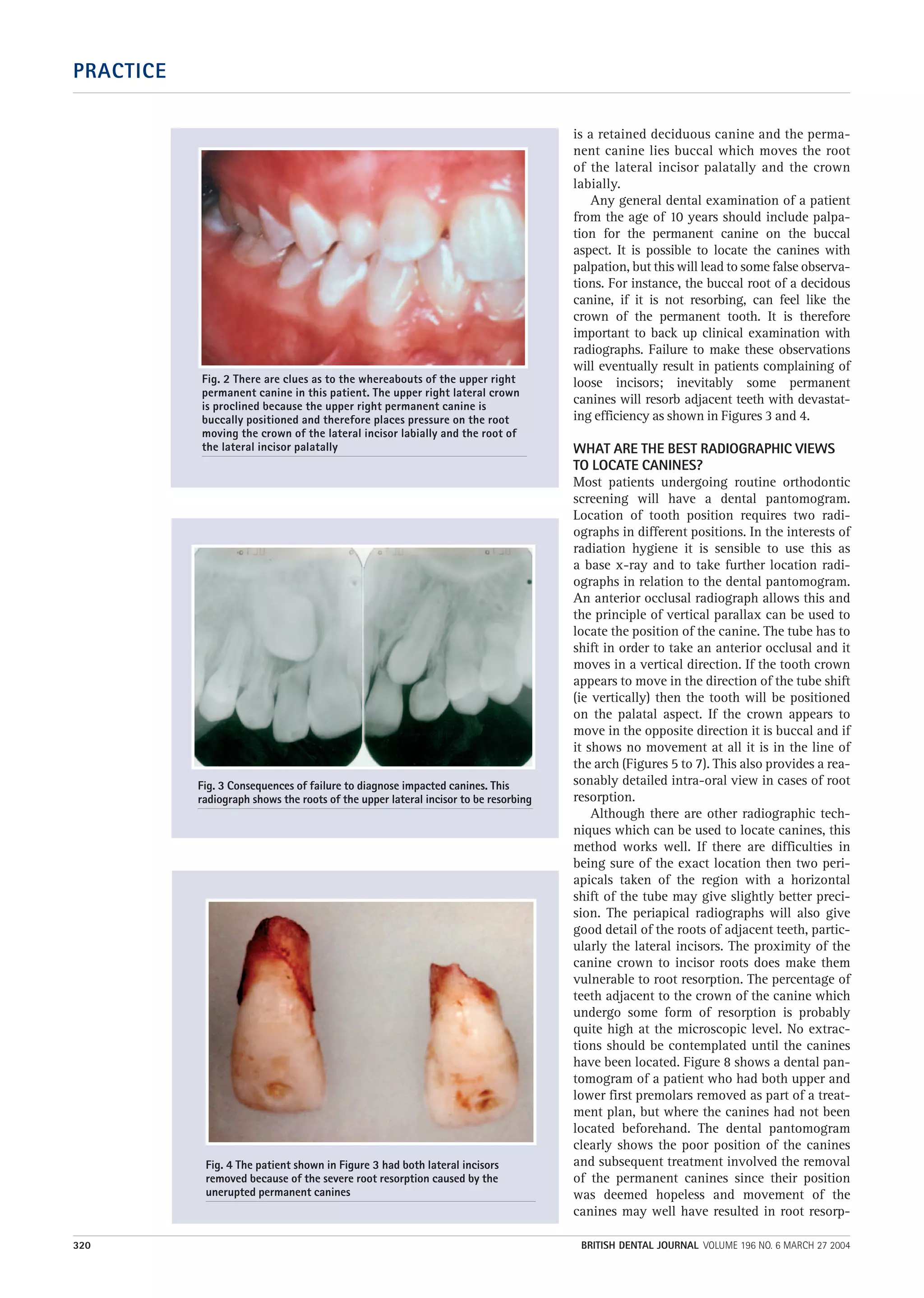 Part 10 impacted teeth | PDF