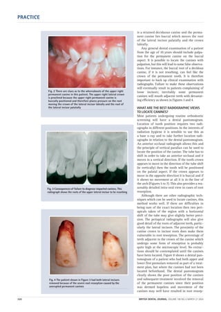 Part 10 impacted teeth | PDF | Dental Health | Diseases and Conditions