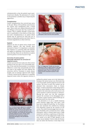Part 10 impacted teeth | PDF | Dental Health | Diseases and Conditions