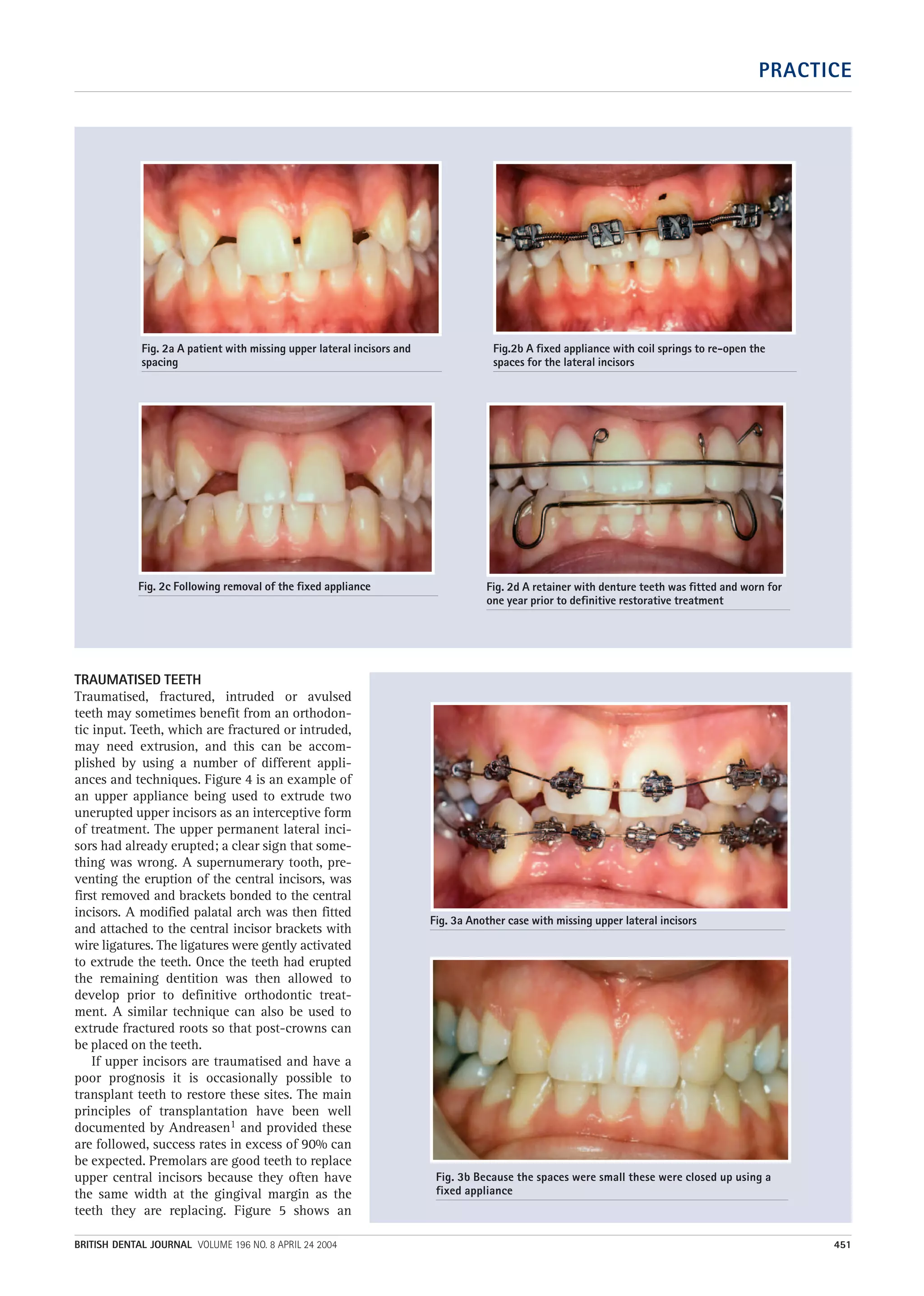 Part 12 combined orthodontic treatment | PDF