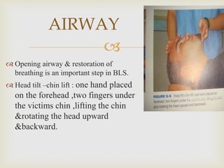 part 1 Medical emergencies in dental practice | PPTX