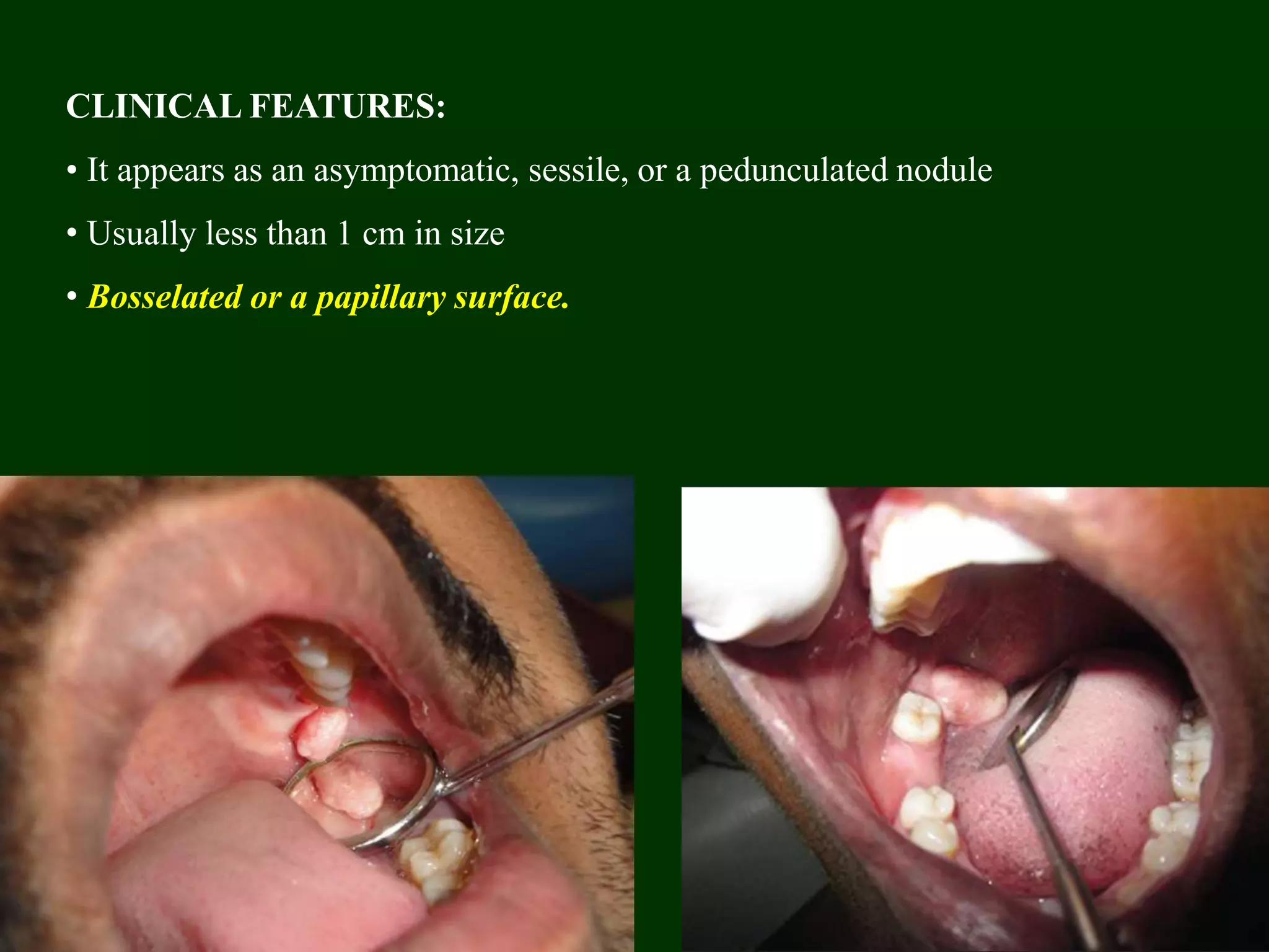 PART 1: SPINDLE CELL LESIONS.pptx
