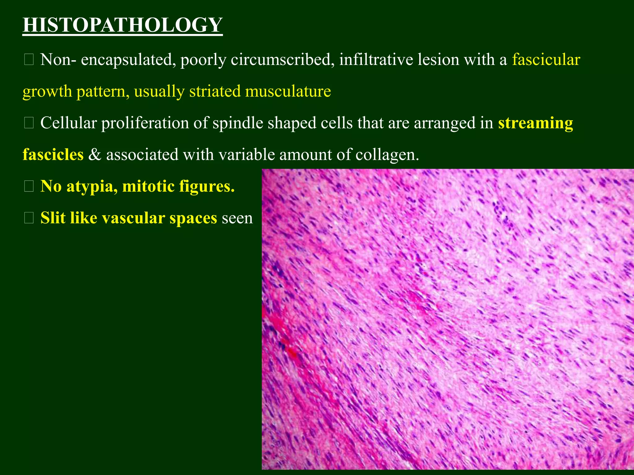 PART 1: SPINDLE CELL LESIONS.pptx