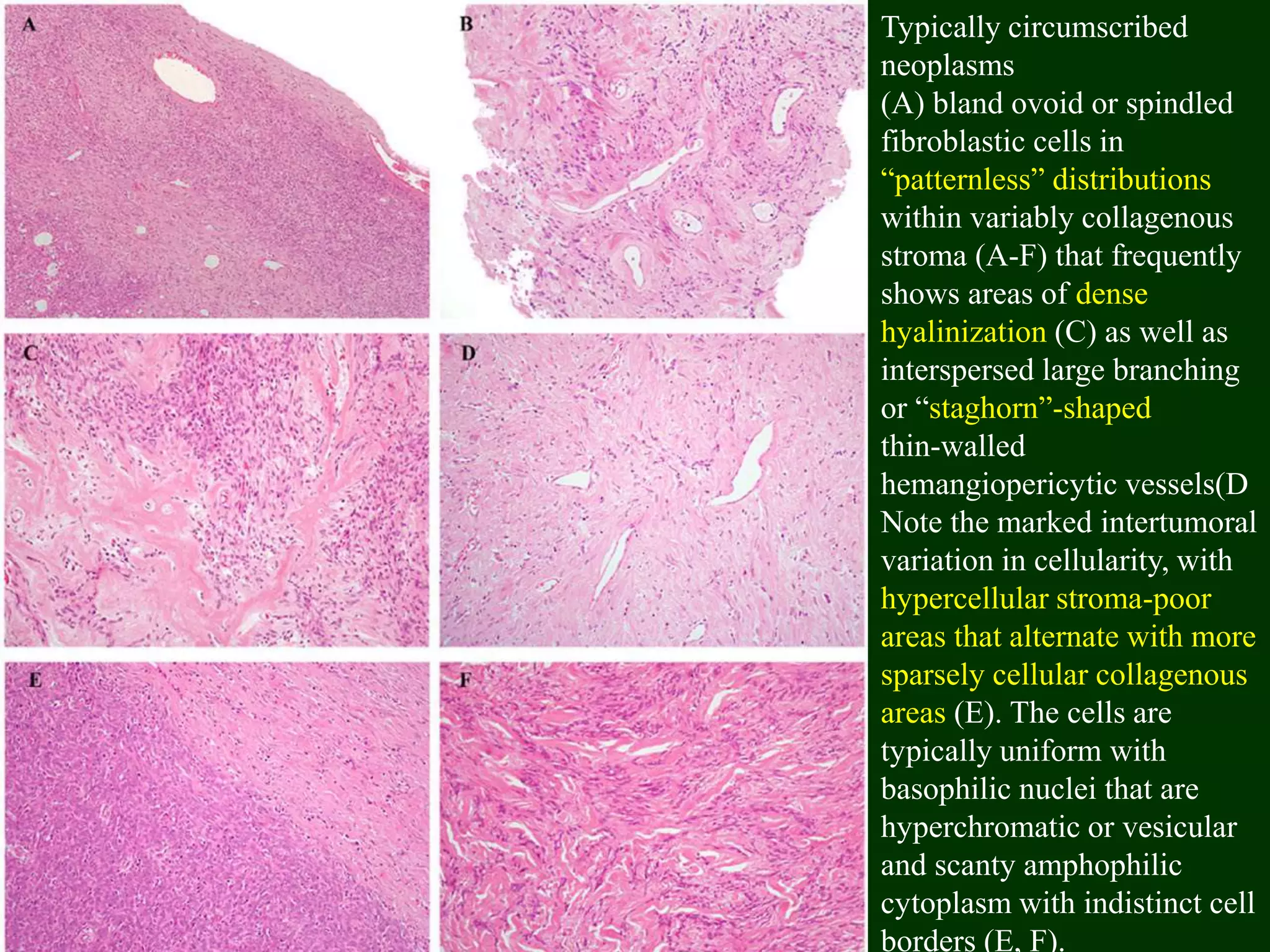 PART 1: SPINDLE CELL LESIONS.pptx