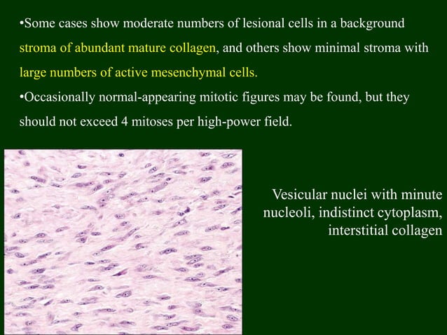 PART 1: SPINDLE CELL LESIONS.pptx | Dental Health | Diseases and Conditions
