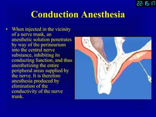 Part2.Anesthesia | PPT