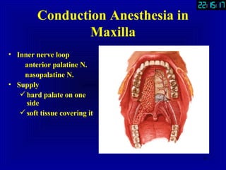Part2.Anesthesia | PPT