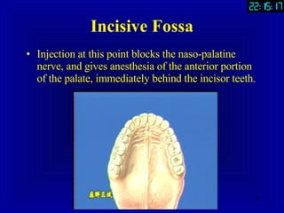 Part2.Anesthesia | PPT
