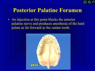 Part2.Anesthesia | PPT
