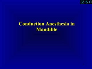 Part2.Anesthesia | PPT