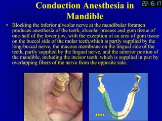 Part2.Anesthesia | PPT