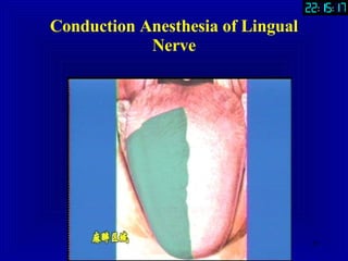 Part2.Anesthesia | PPT