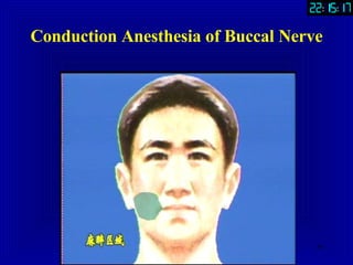 Part2.Anesthesia | PPT