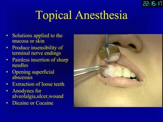 Part2.Anesthesia | PPT