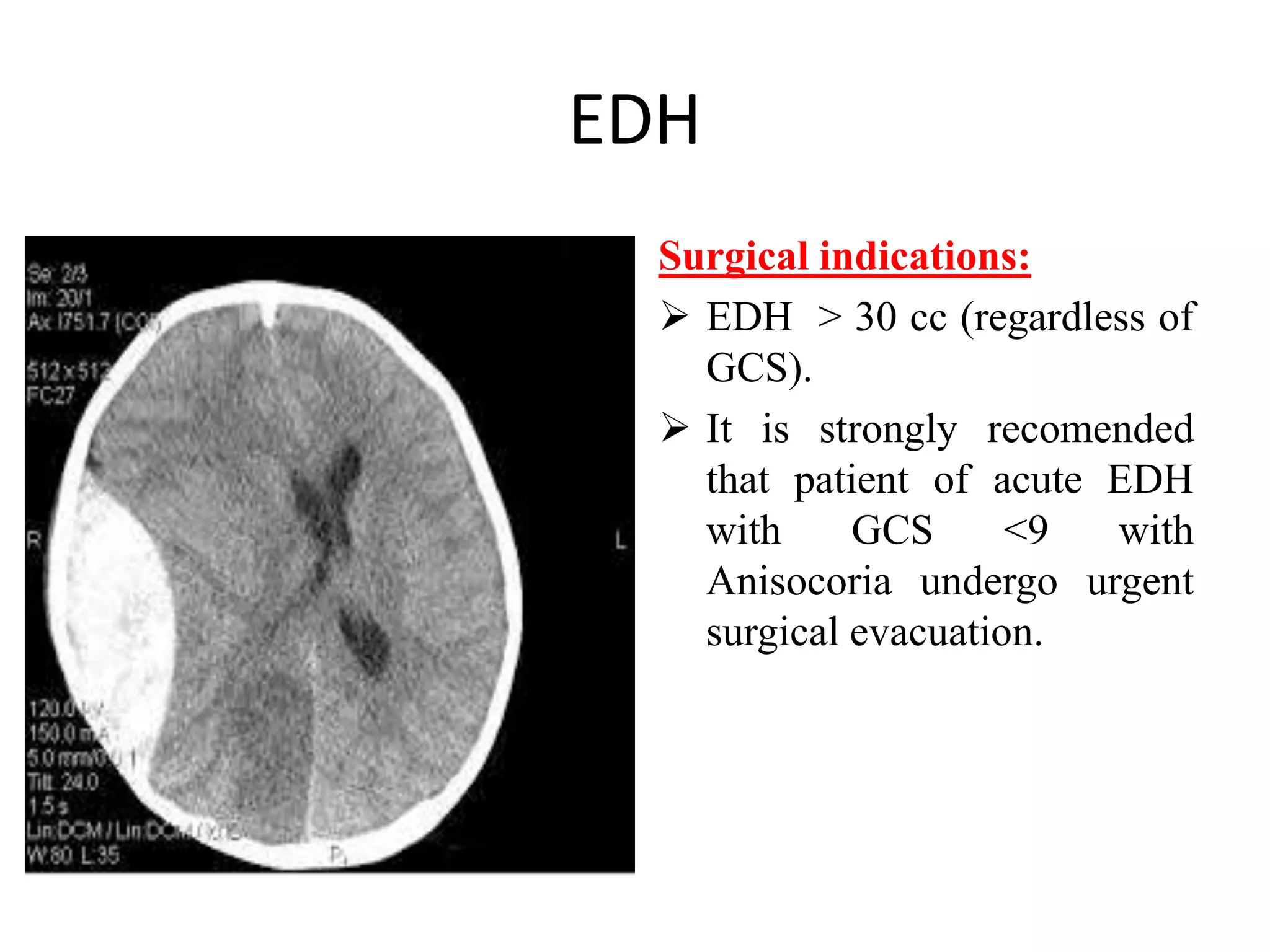 MANAGEMENT OF RAISED INTRACRANIAL PRESSURES | PPTX