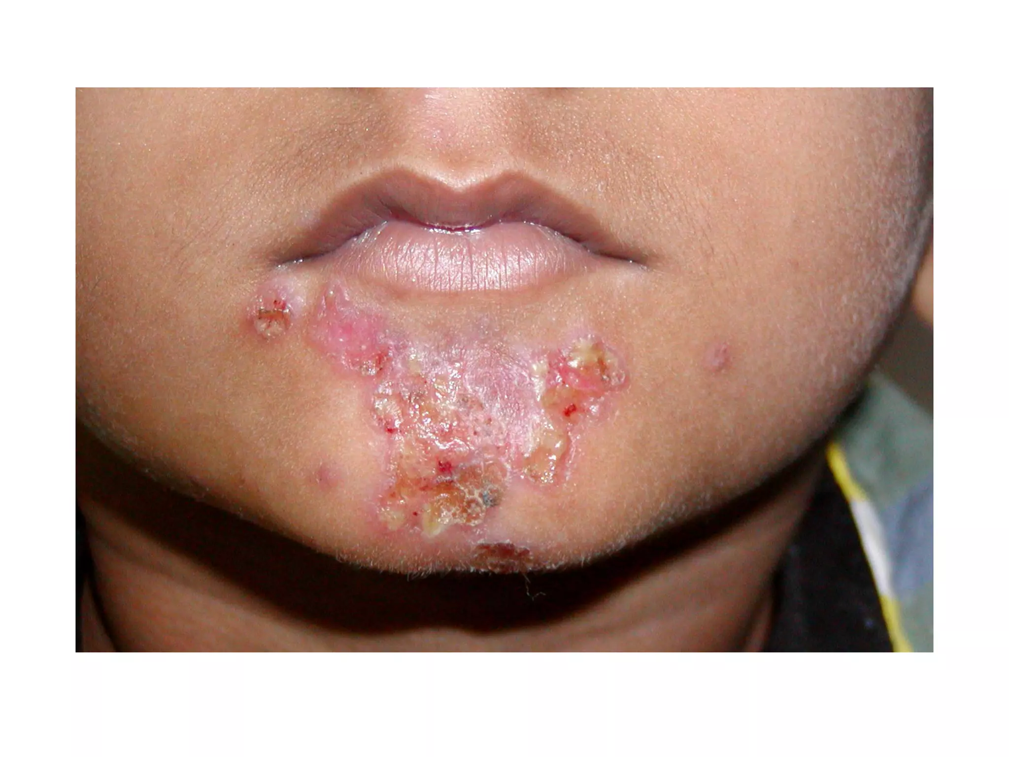 Part 2 skin disorders lecture-pictures(kirin) | PPT