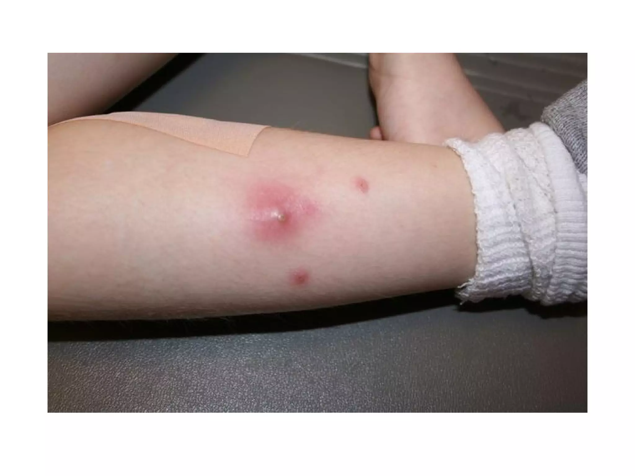 Part 2 skin disorders lecture-pictures(kirin) | PPT