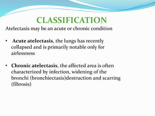 PART 21--Atelectasis In children.pptx