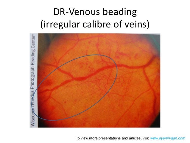 Part 2 fundus imaging – presentation for www.eyenirvaan.com