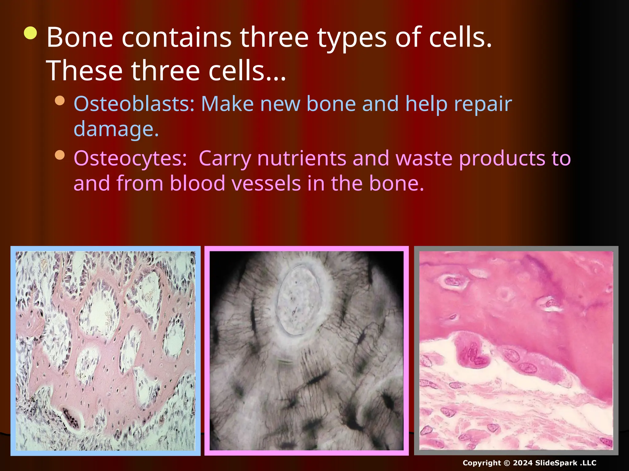 Introduction to the Skeletal System Lesson, Middle Level Science Lesson, from SlideSpark Science ...