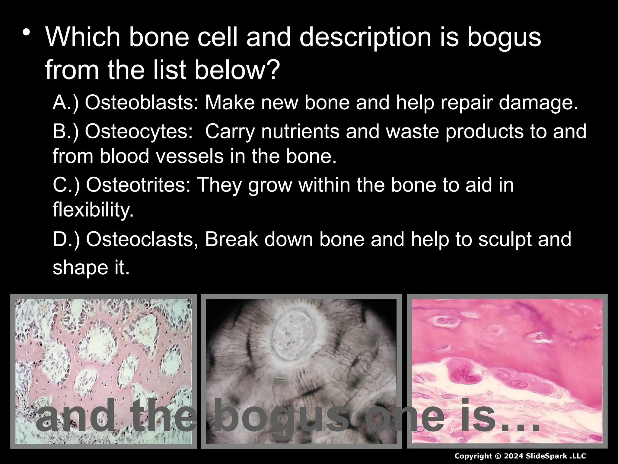 Introduction to the Skeletal System Lesson, Middle Level Science Lesson ...