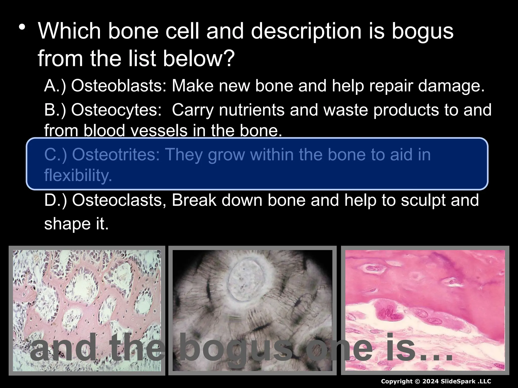 Introduction to the Skeletal System Lesson, Middle Level Science Lesson ...