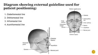 Radiographic Techniques in Pediatric Dentistry - Part Two....... | PPTX