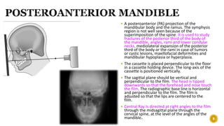 Radiographic Techniques in Pediatric Dentistry - Part Two....... | PPTX