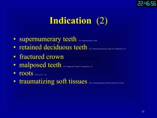 Part3.Extraction Of Teeth | PPT