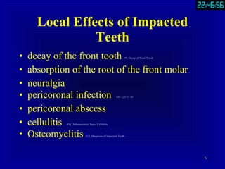 Part3.Extraction Of Teeth | PPT