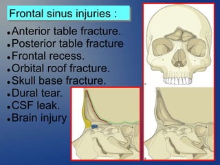 Part 4 end | PPT