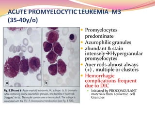 Part 4 Acute Myeloid Leukemia | PPTX