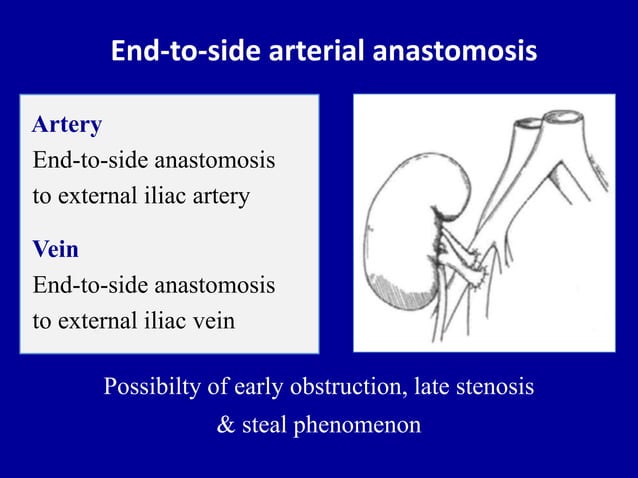 Part 4 doppler usg of renal artery stenosis in transplant kidney | PPT