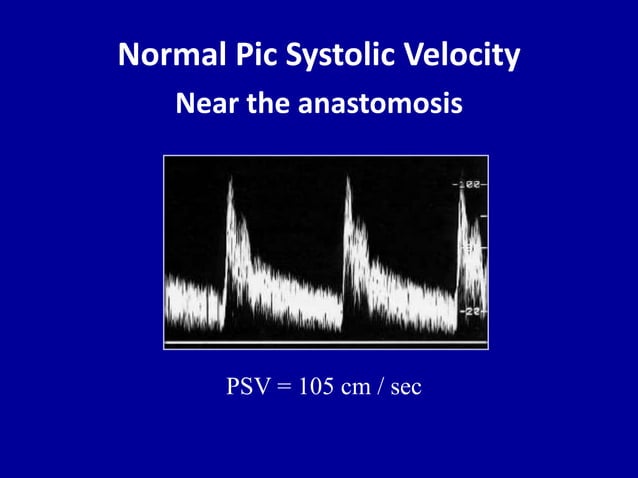 Part 4 doppler usg of renal artery stenosis in transplant kidney | PPT