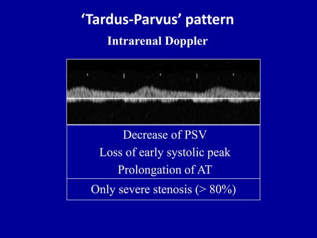 Part 4 doppler usg of renal artery stenosis in transplant kidney | PPT